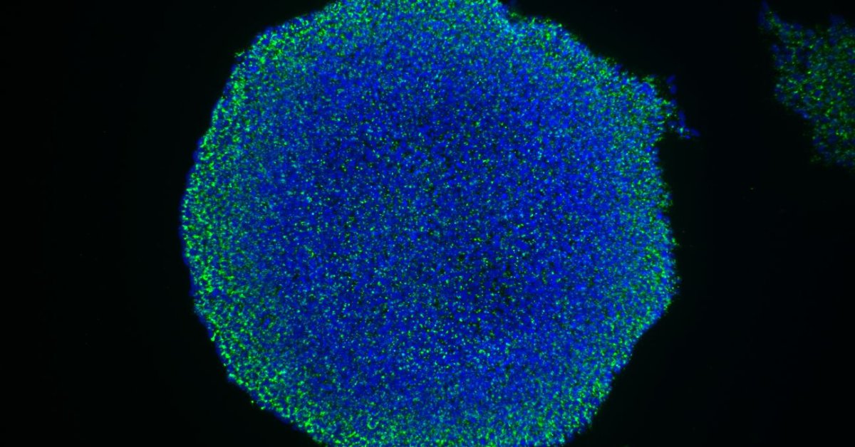 Induced Pluripotent Stem Cells | Amsterdam UMC